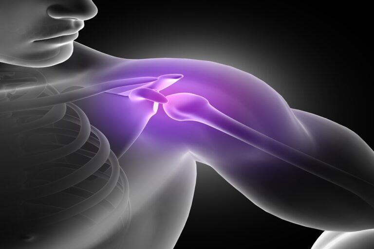 Understanding Shoulder Joint Replacement: A Comprehensive Guide ...